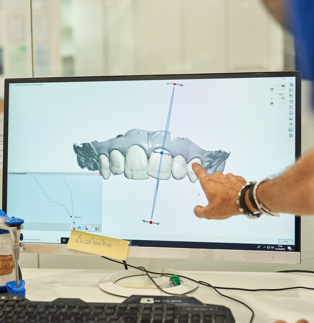 DENTAL CAD DESIGN - VCAD Dental Lab